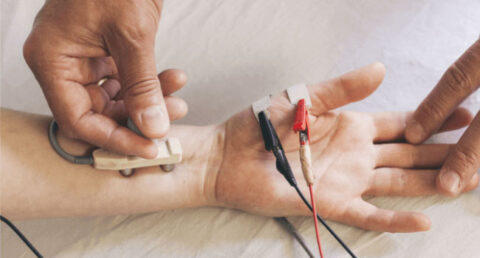 Nerve Conduction Velocity Overview - Dr. Poornima Shah